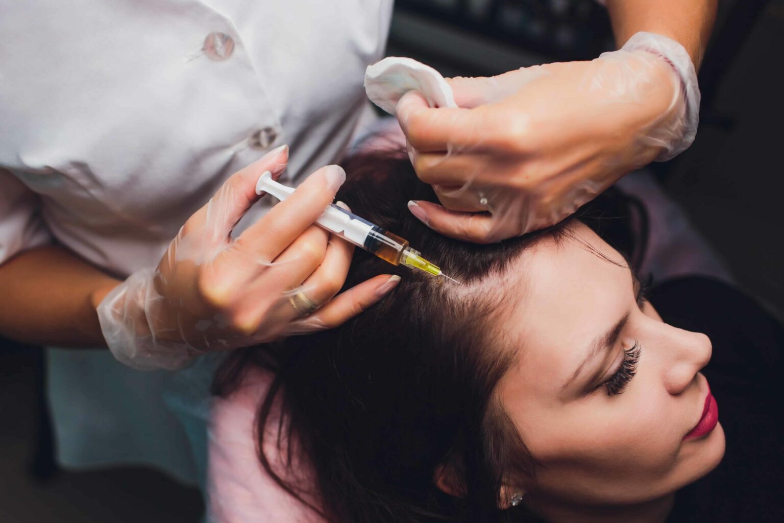 What Are The Benefits Of PRF Therapy